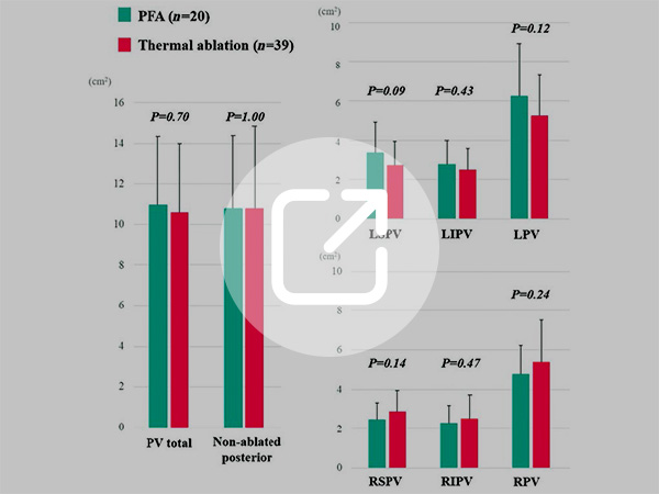 PFA Clinical Publications - Boston Scientific - Boston Scientific